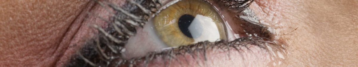 Epiphora - The Eye Practice