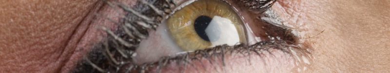 Epiphora - The Eye Practice