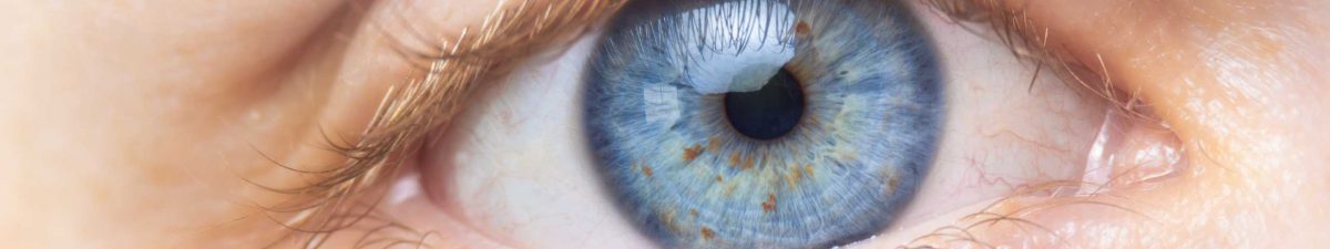 Recurrent Corneal Erosion - The Eye Practice