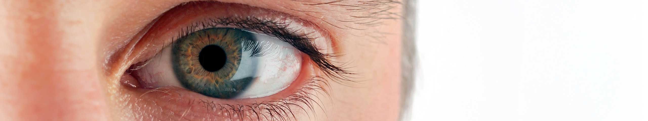 Meibomian Gland Swelling