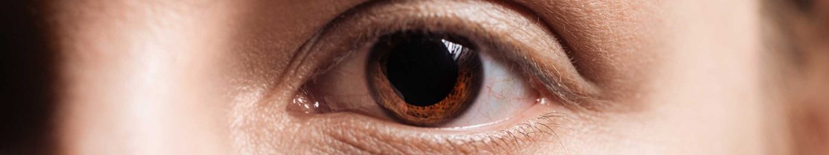 Keratoconus types - The Eye Practice